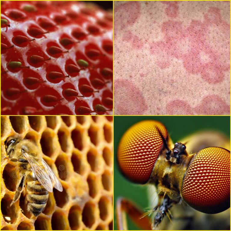 Should I seek counseling for my fear of holes (Trypophobia)? - stuarte
